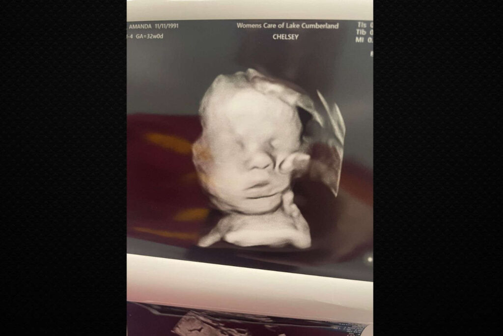 Mother's Prayer Answered as 'Hand of God' Appears in Baby's Ultrasound ...